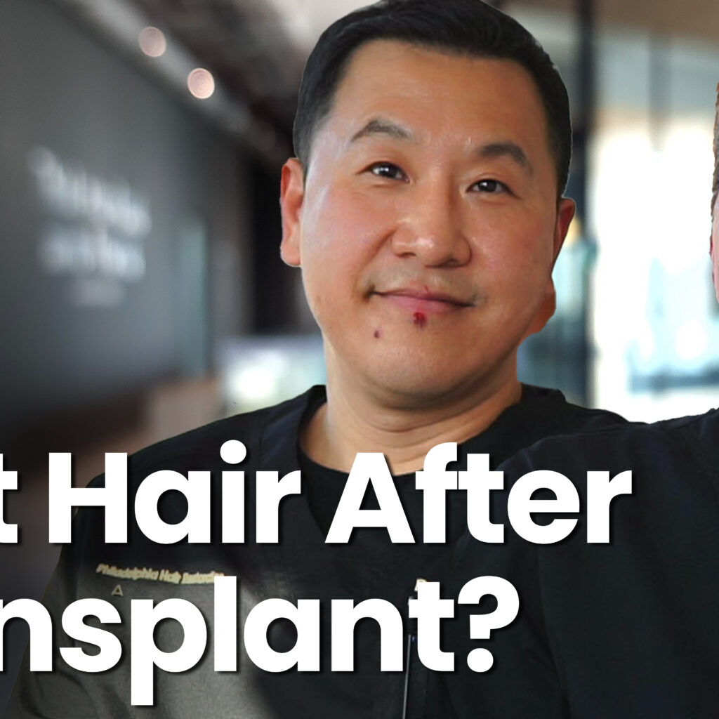 Hair Transplant Shock Loss | Video Guide & Causes